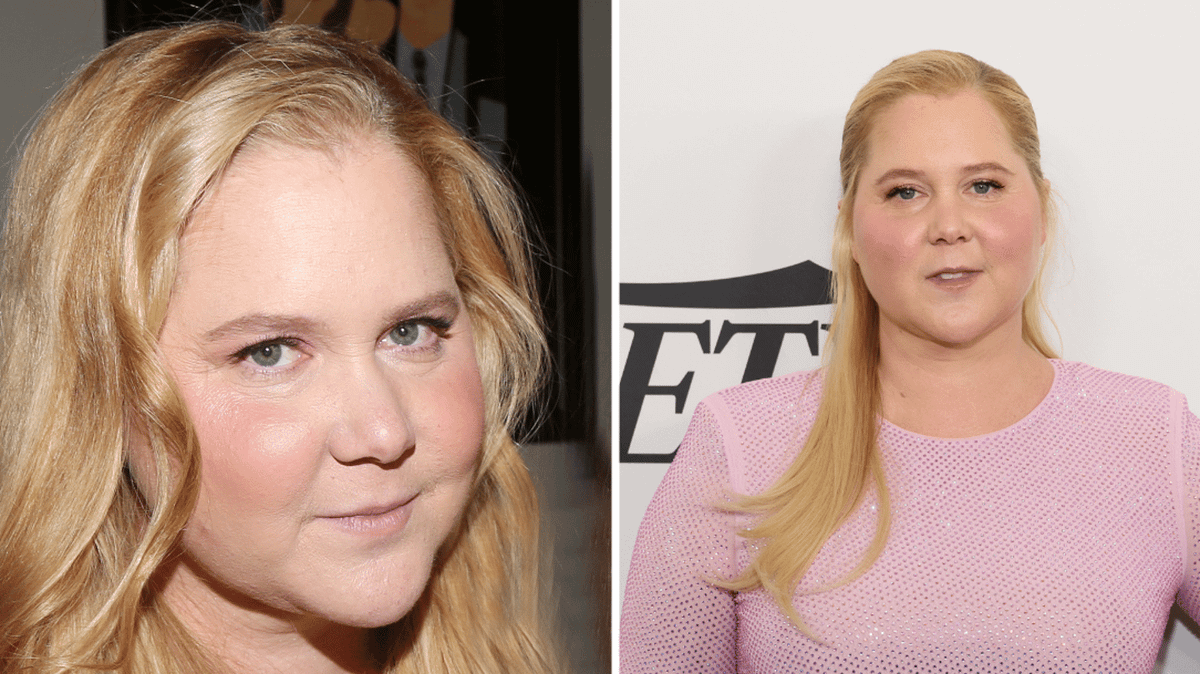 Amy Schumer had perfect response to concern about her ‘puffier face’ as ...