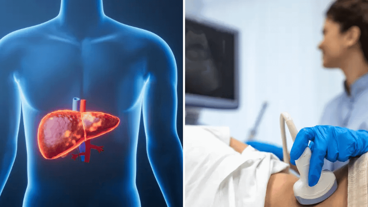 Doctor issues warning over five signs that could mean you have serious ...