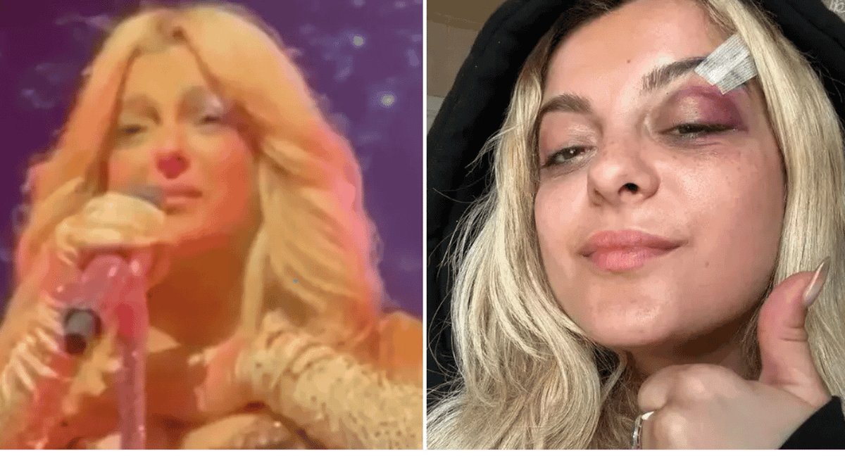 Bebe Rexha addresses having phone thrown at her face as she returns to ...