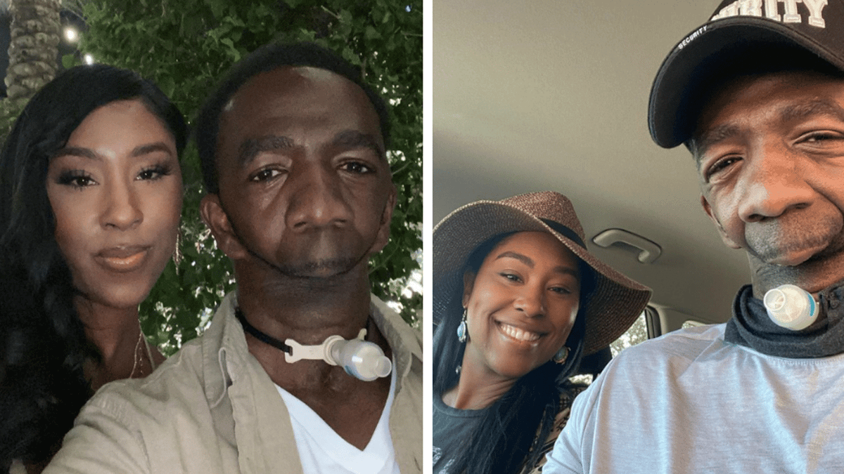 Man with no jaw falls in love and shares his incredible story