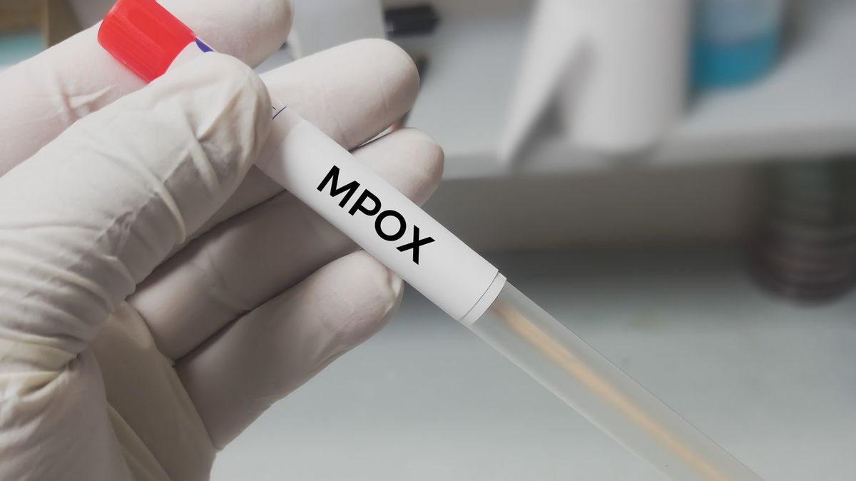 Experts reveal one unusual mpox symptom you should never ignore