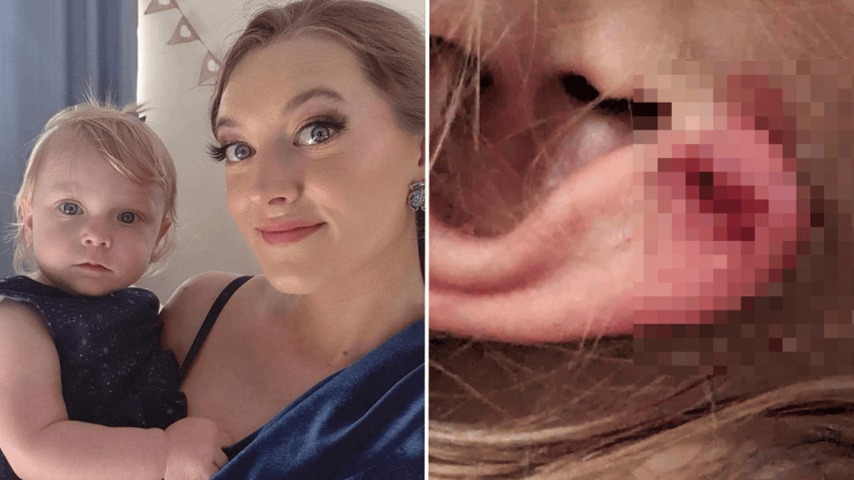 Three-year-old British girl rushed to hospital after clip-on earrings ...