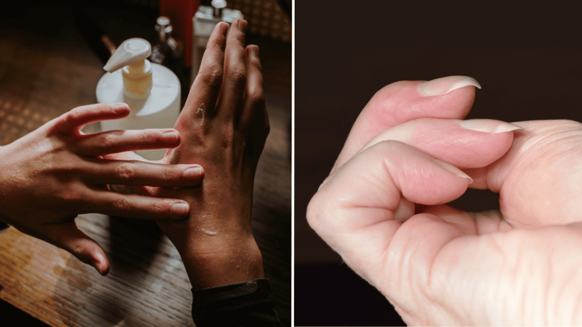 GP reveals warning sign to look out for on fingers that could lead to ...