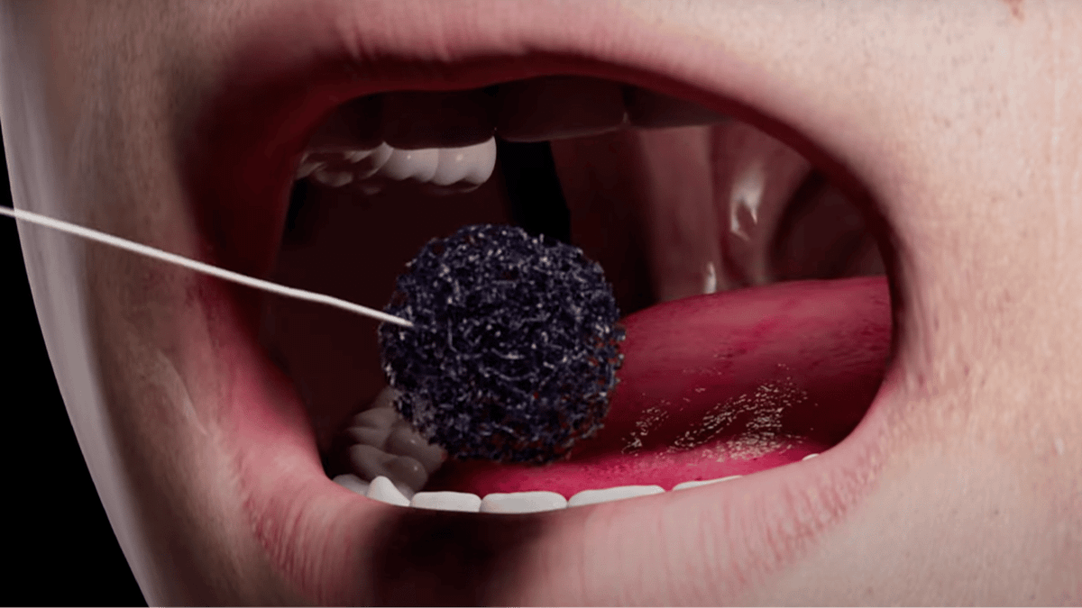 Simple sponge test can help find cancer 'hiding in plain sight' as ...