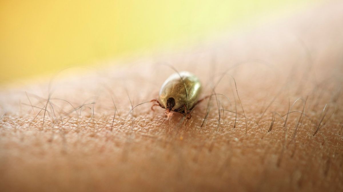 Three stages of Lyme disease explained as Justin Timberlake confirms ...