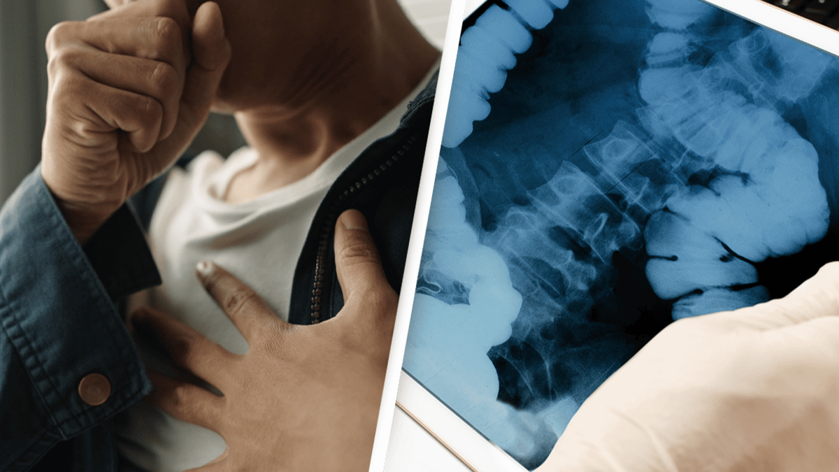 Man’s intestines fall out of his body after coughing and sneezing while ...