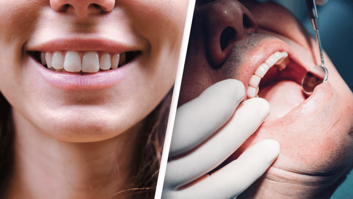 Scientists reveal the 'real reason' why people have crooked teeth and ...