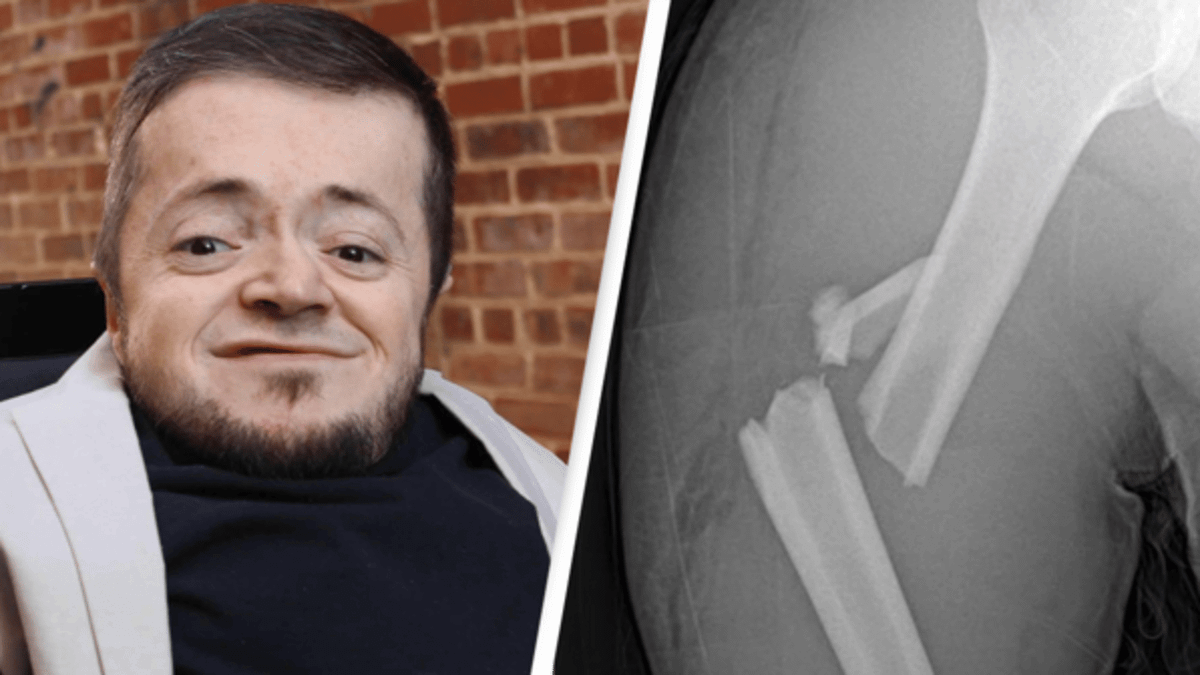 Man reveals harsh reality of living with rare disease that causes ...