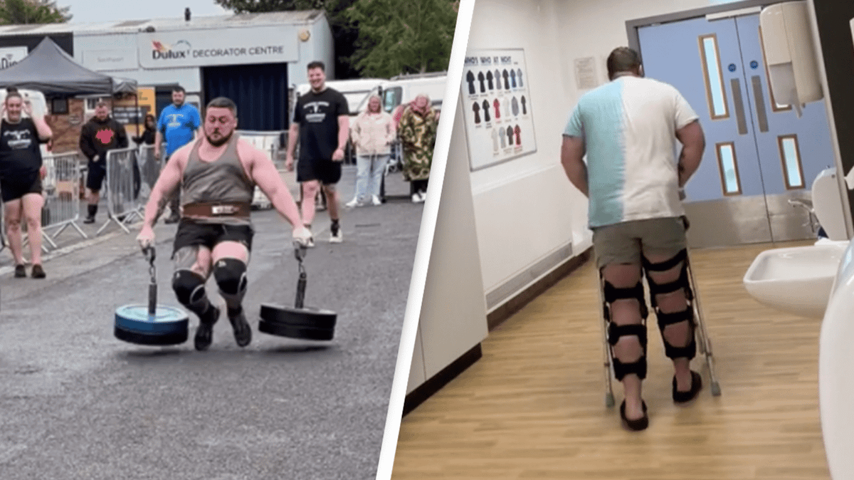 Man shares update after his kneecaps ‘shot up’ his thighs as tendons ...