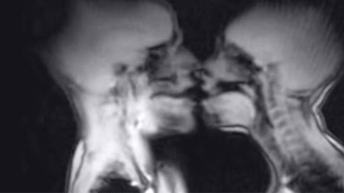 Couple Had Sex In Mri Machine To Show What Happens Inside Body