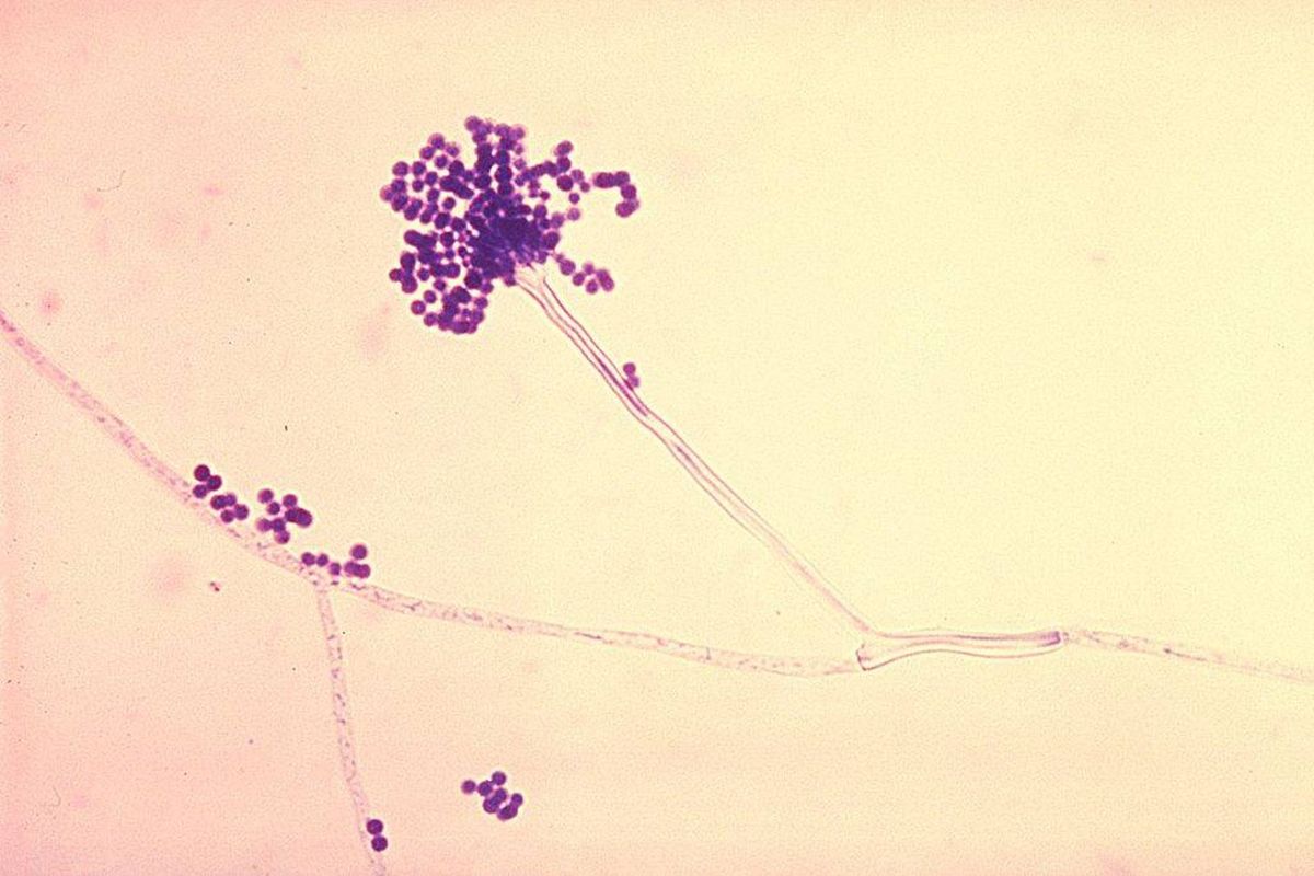 Five US states at risk as deadly airborne virus that eats human tissue ...