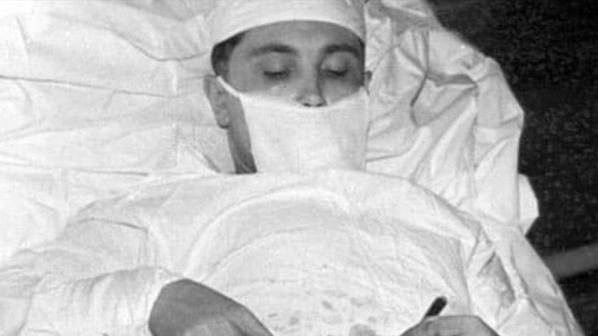Incredible story of surgeon who saved own life performing own appendix ...