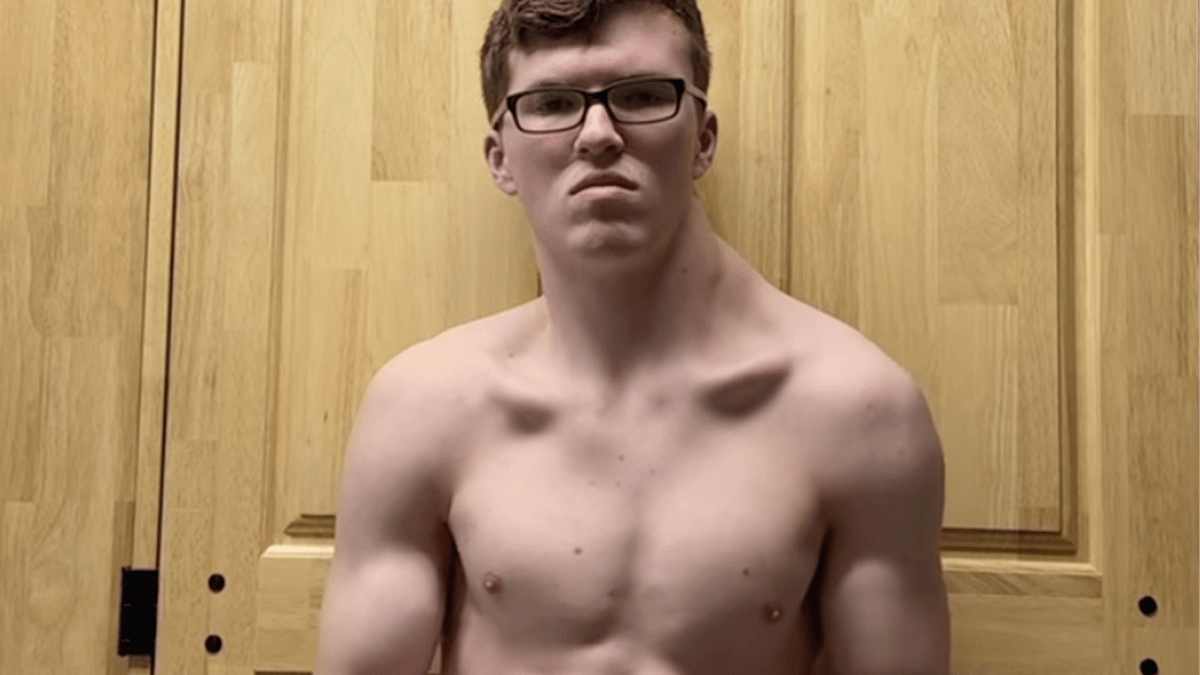 'Crooked Man' shows severe impact after only weight training one side ...
