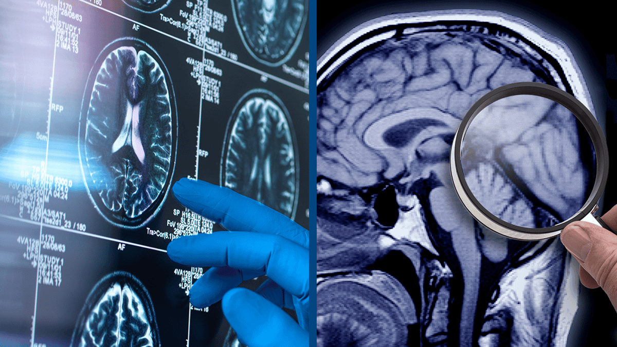 Scientists have measured the exact speed of human thought and the ...