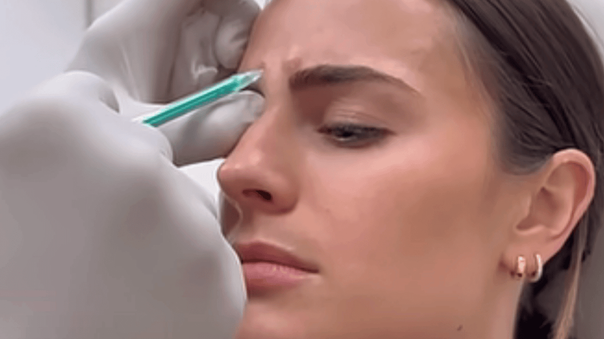 Woman compared face before and after Botox injections to show major ...