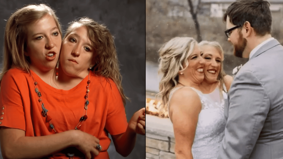 Conjoined twins Brittany and Abby explain what happens when they get sick