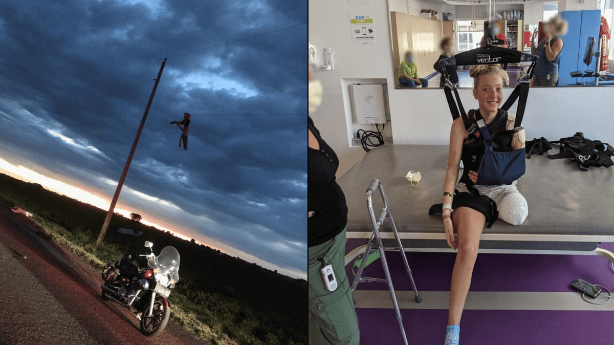 Teenager left hanging by broken leg on power line after car crash says ...
