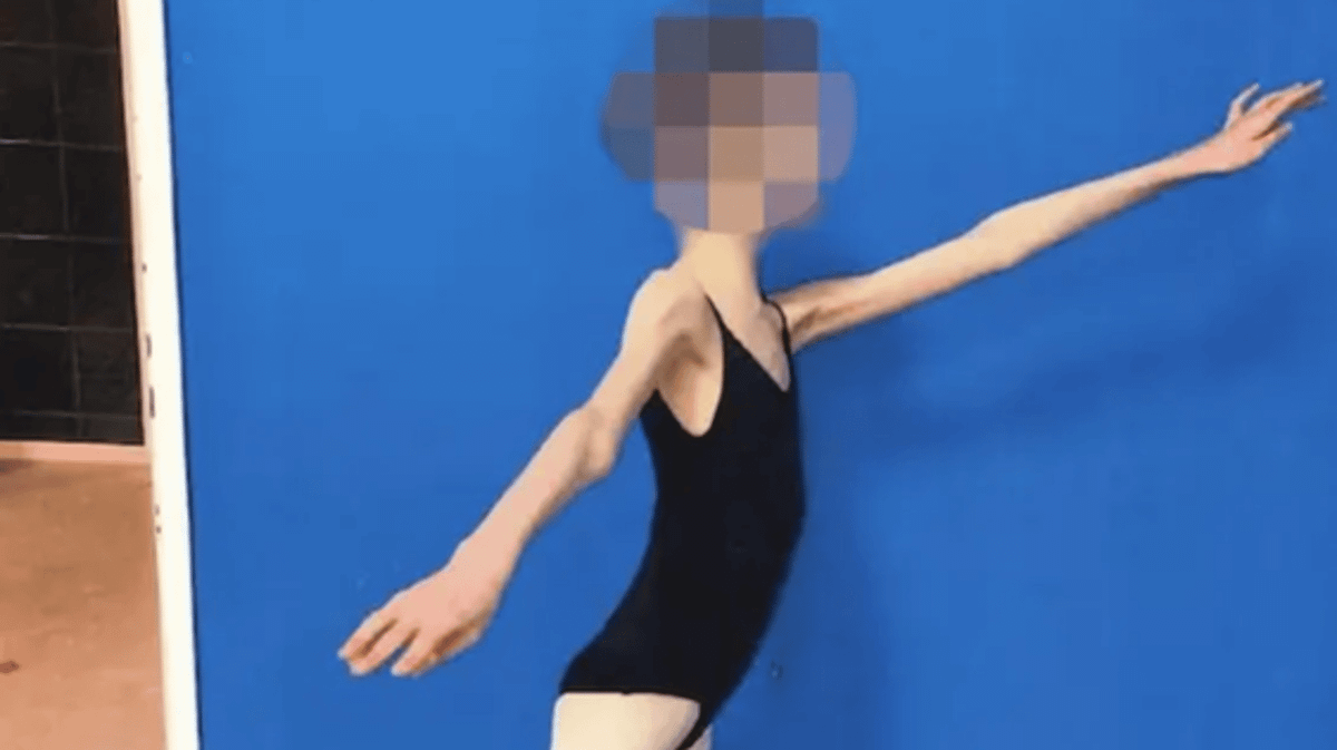 Parents who starved teenage ballerina daughter until she was four stone ...