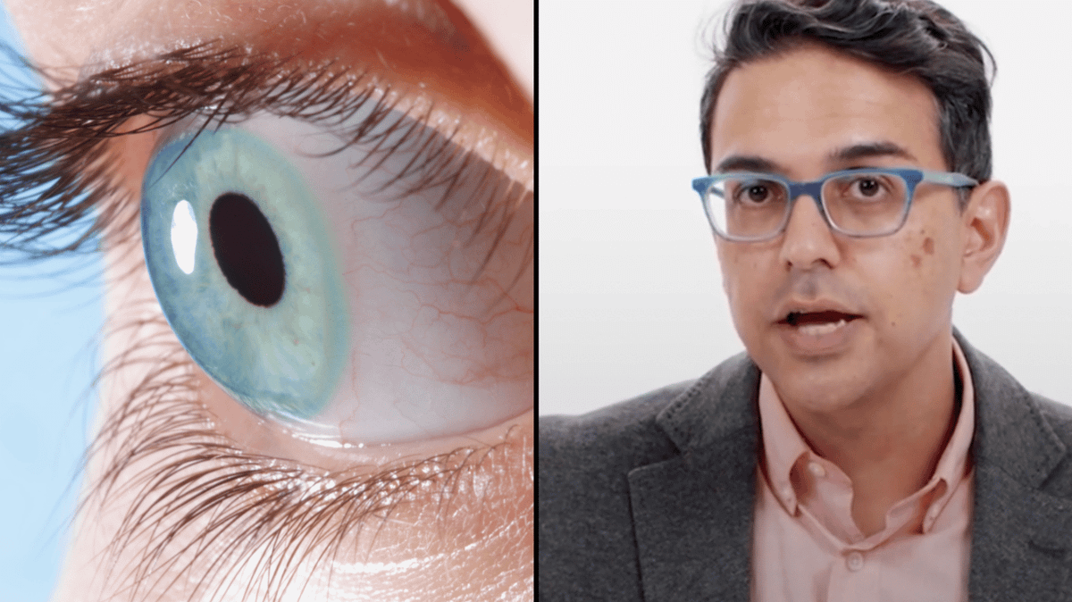 Doctor weighs in on mind-blowing theory that every blue-eyed person is ...