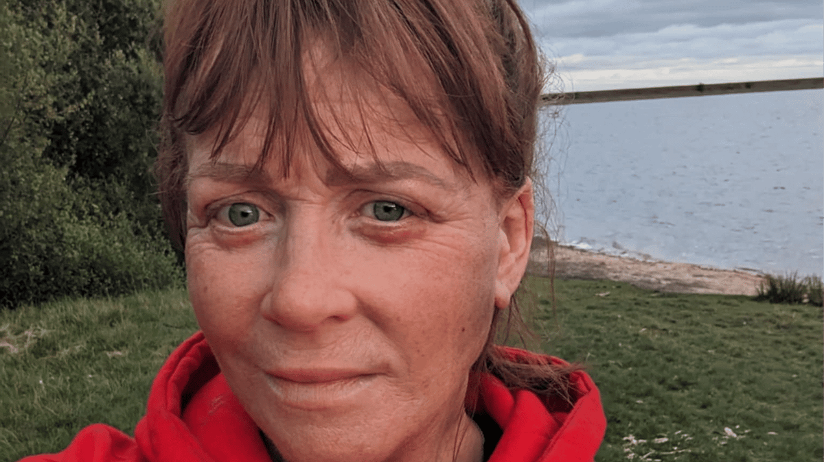 Woman left unable to close eyes from 'horror surgery' after wanting ...