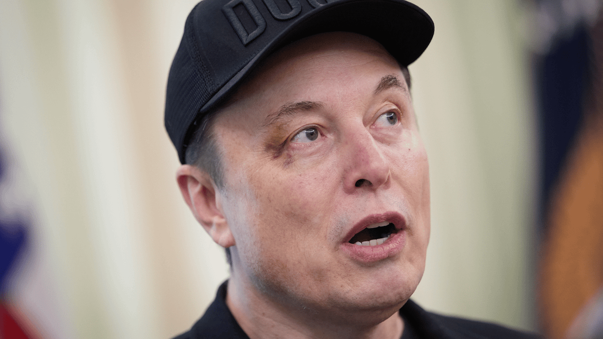 Elon Musk turns up to farewell press conference with black eye ...