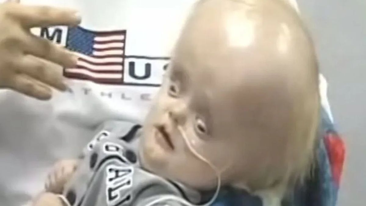 Boy born without a brain lived to the age of 12