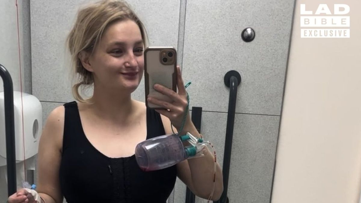 Woman who managed to get 'rare' breast reduction on NHS reveals why ...