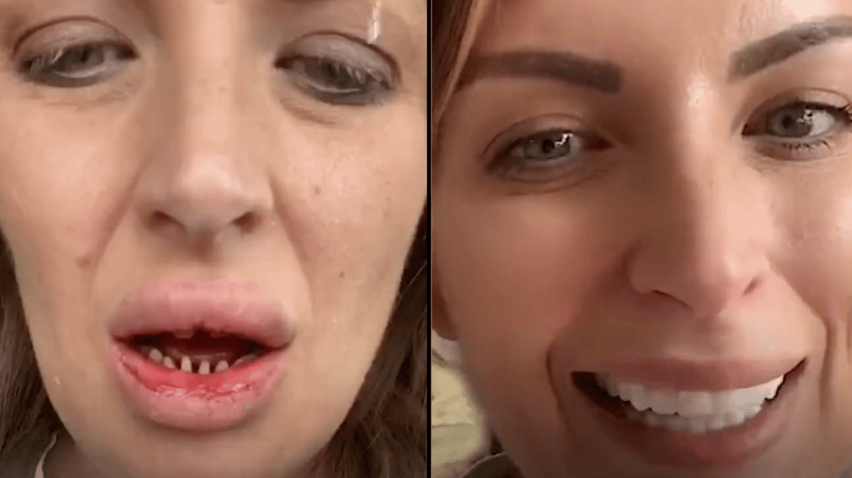 Woman issues massive warning to people getting cheap dental work in ...
