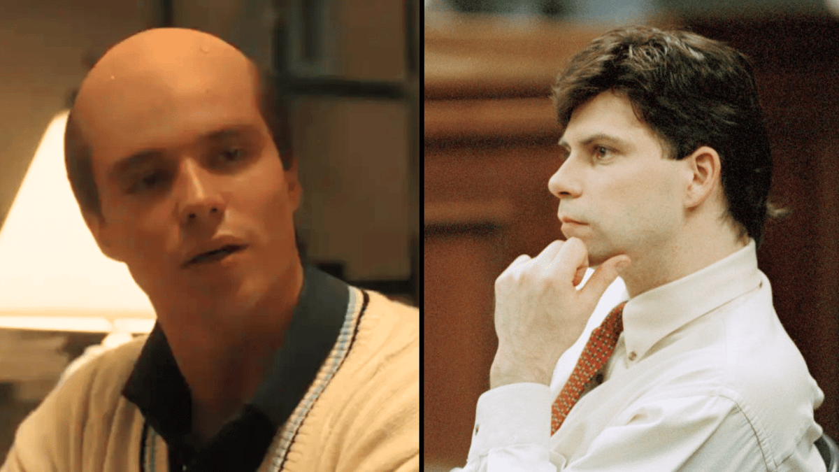 Truth behind whether Lyle Menendez lost his hair as shown in Netflix ...
