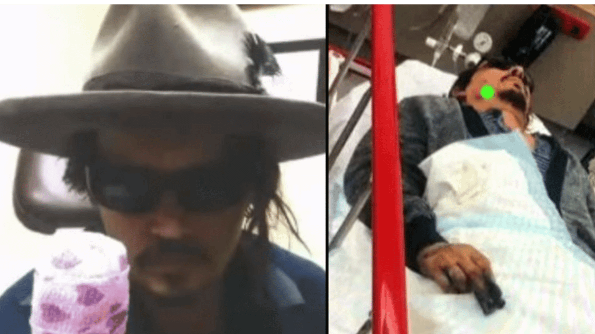 Court Is Shown Picture Of Johnny Depp's Finger Bandaged Up After ...