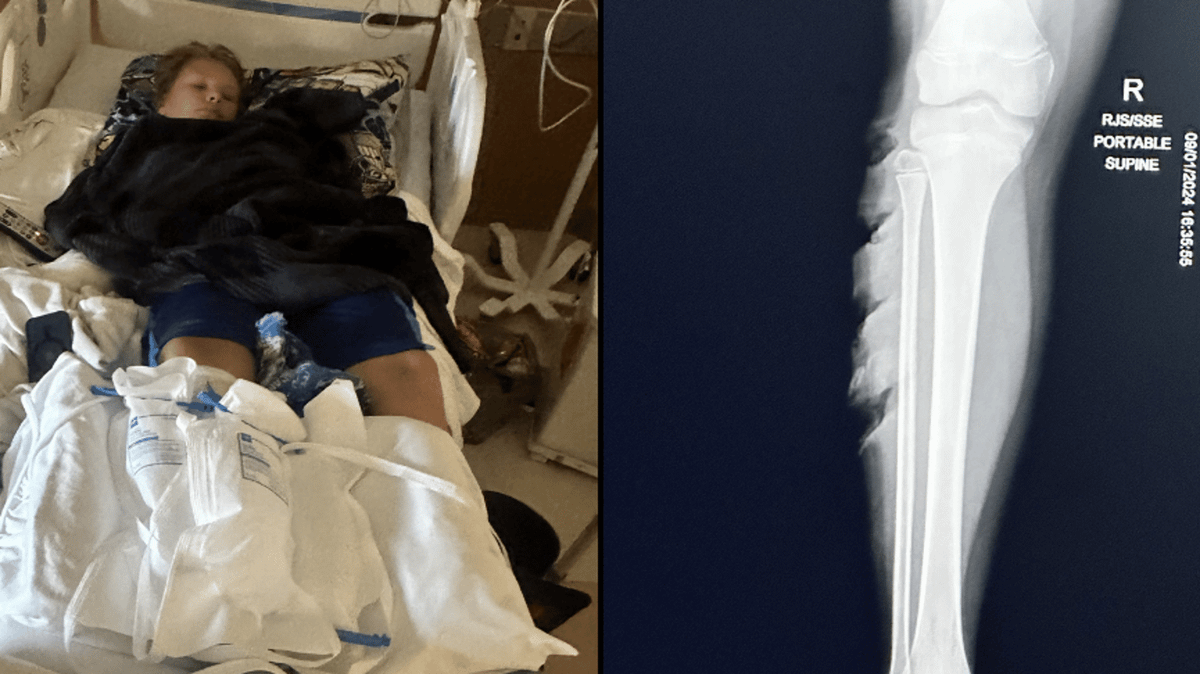 Mum feared son ’wouldn’t make it’ after having leg sucked into boat ...