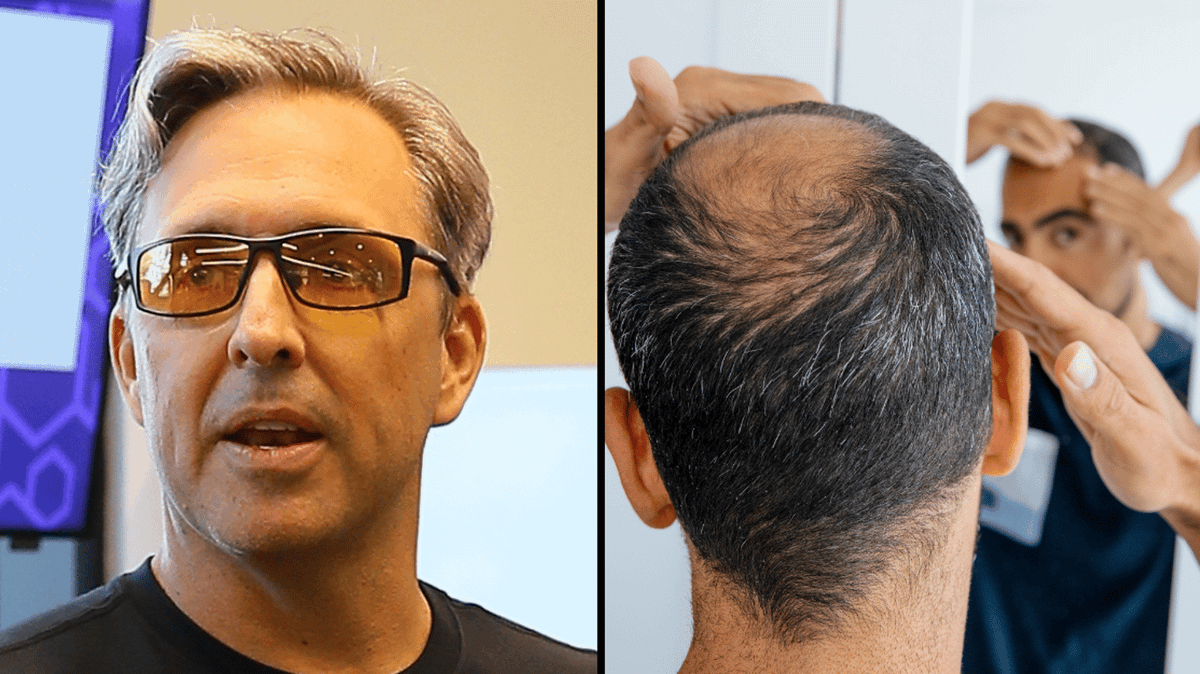 Biohacker reveals easy way to stop hair loss in your 20s and 30s