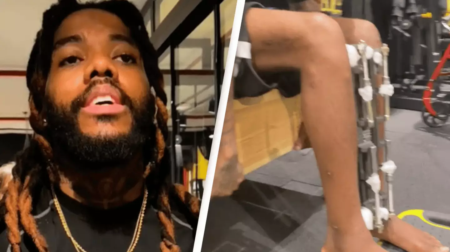 Chicago Man Who Underwent Height Surgery To Go From 5 6 To 6 Feet Chicago Man Who Underwent Height Surgery To Go From 5 6 To 6 Feet